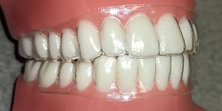 Clear Aligners - Online Dental Care